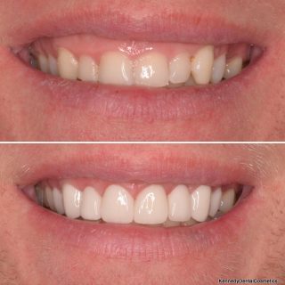 Dental Clinic Paddington | Dentist Paddington | Kennedy Dental Cosmetics